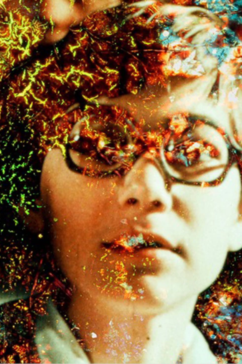 Pigment-Dispersion Syndrome Movie Streaming Online Watch